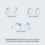 Toe Alignment Splint - DARCO International
